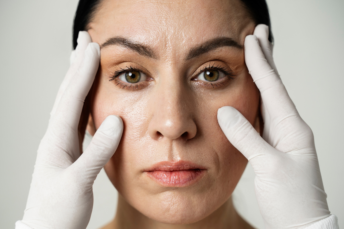 Deep Forehead Wrinkles – Photozyme